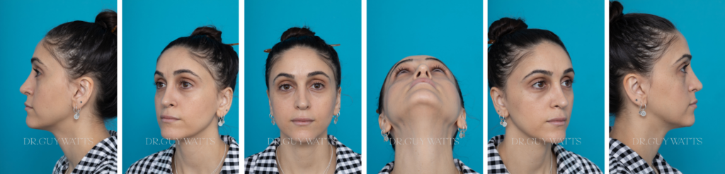 Complimentary Photo Assessment. How To Take Photos - Dr Watts